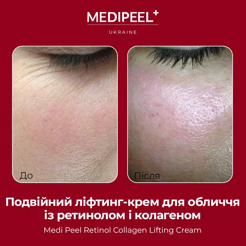 MEDIPEEL Retinol Collagen Lifting Cream - Антивіковий Ліфтинг-крем з Ретинолом