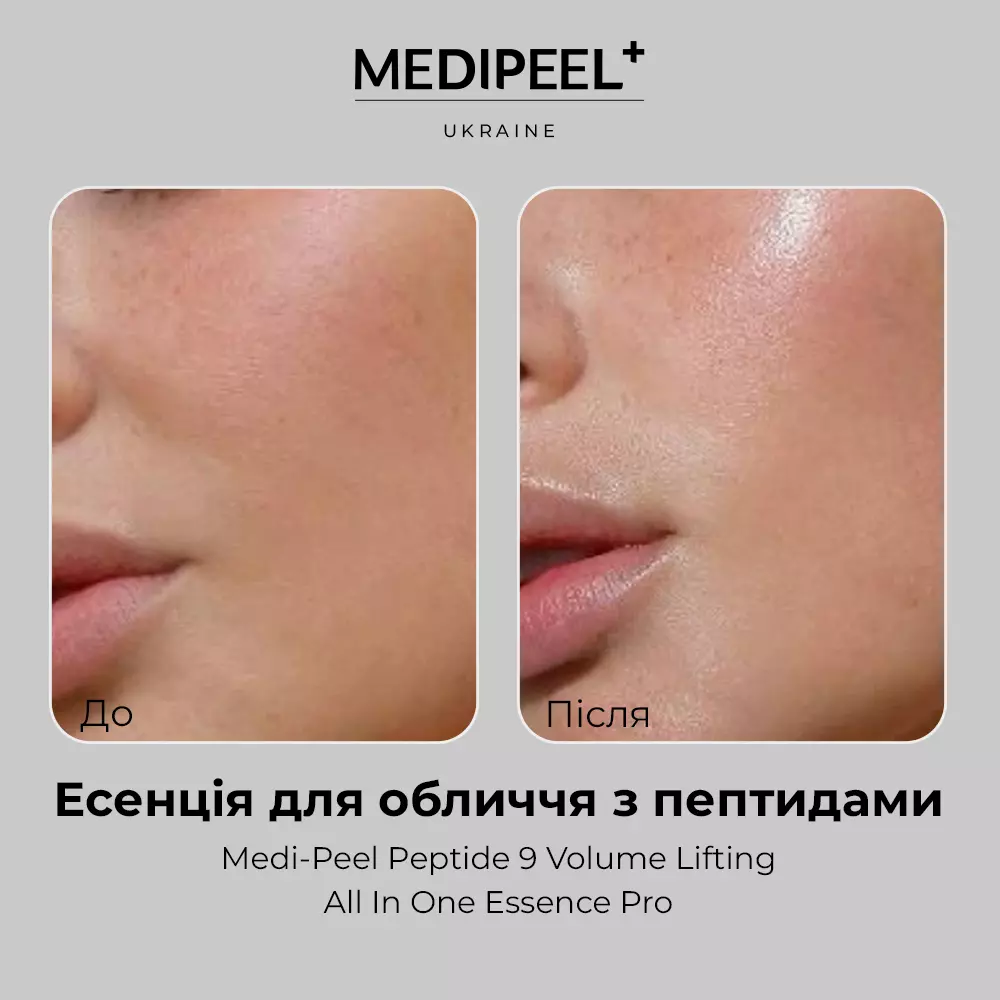 MEDIPEEL Peptide 9 Volume Lifting All In One Essence Pro: Революційна Ліфтинг-Есенція для Обличчя