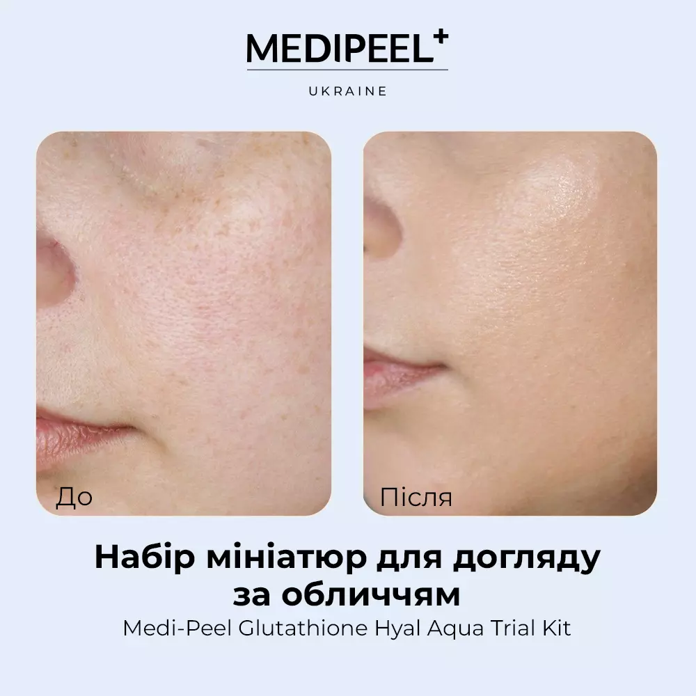 MEDIPEEL Glutathione Hyal Aqua Trial Kit: Трансформація Шкіри